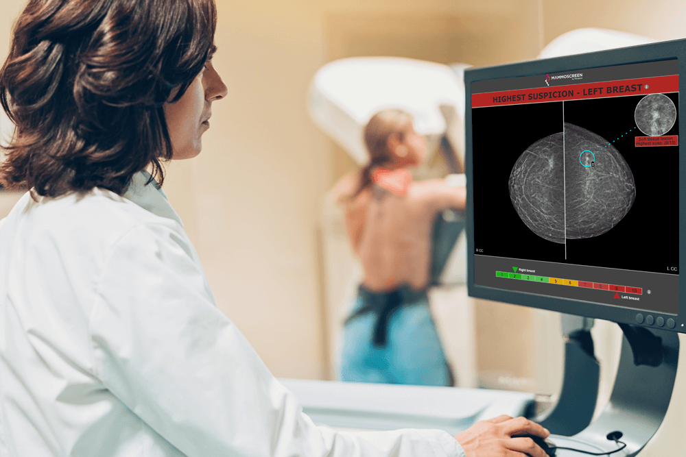 Artificial Intelligence for Breast Cancer Screening - MammoScreen™