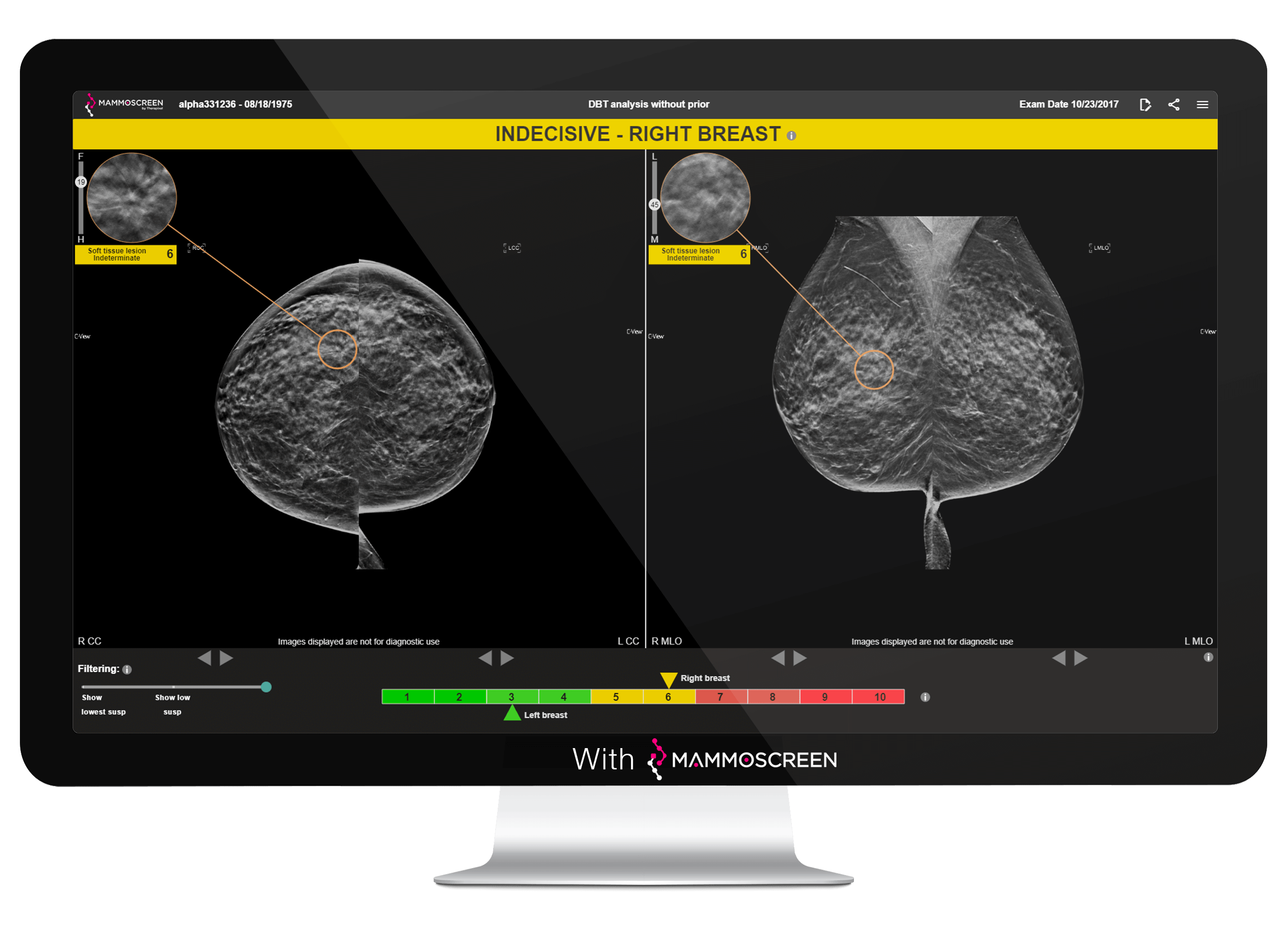 How it works - MammoScreen®